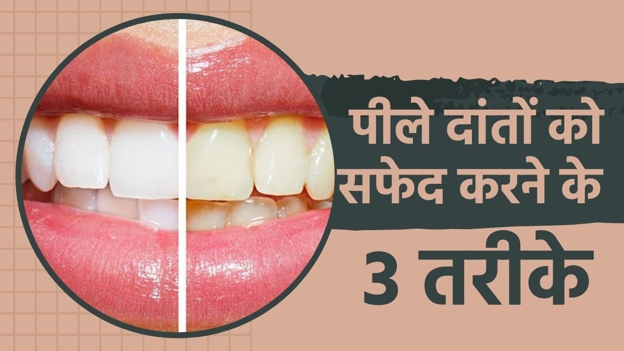 दांतों को चमकाने के लिए अपनाएं घरेलू तरीके…. - India Mitra